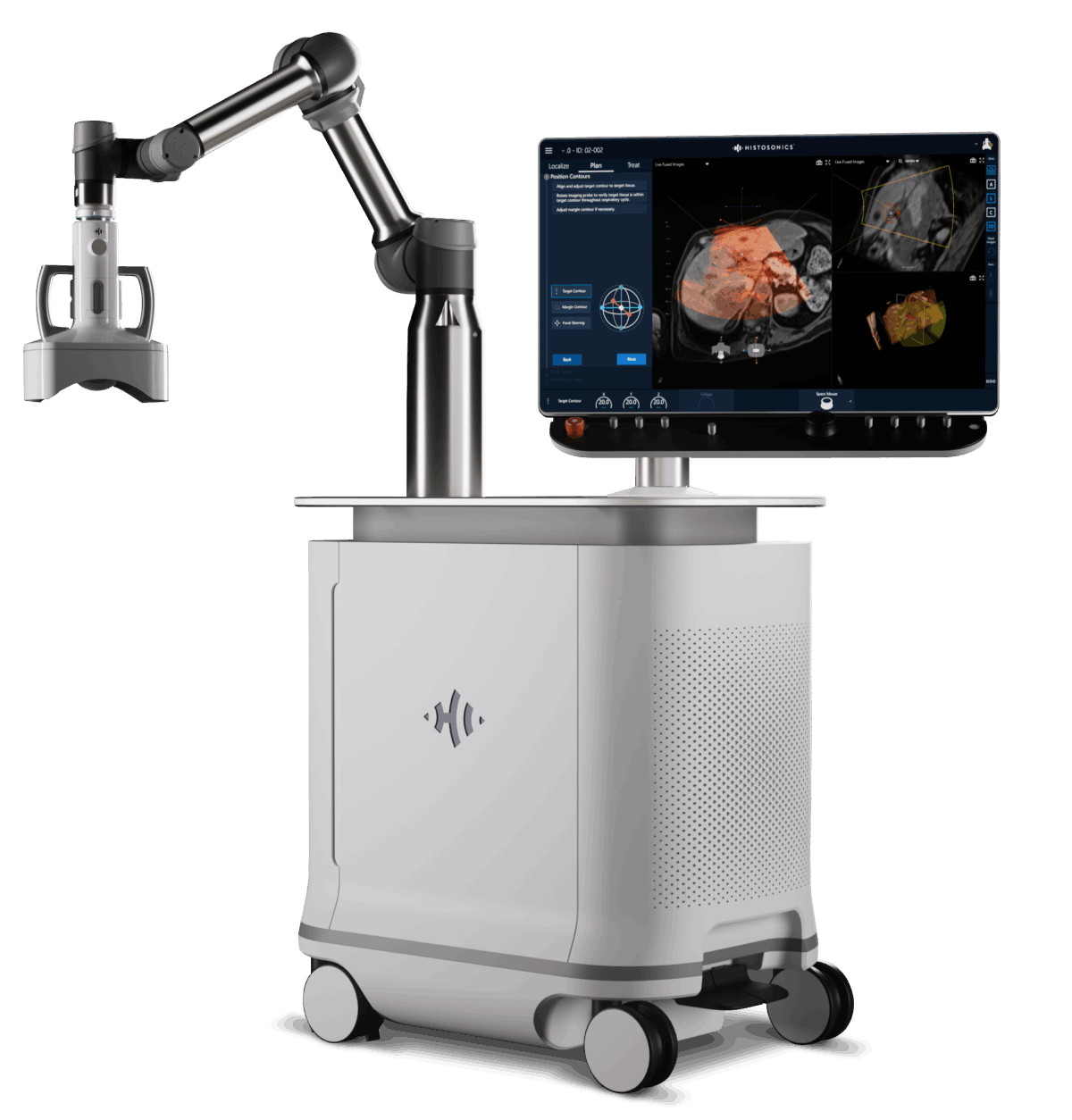 Histotripsy, Liver Cancer Treatment | NGHS